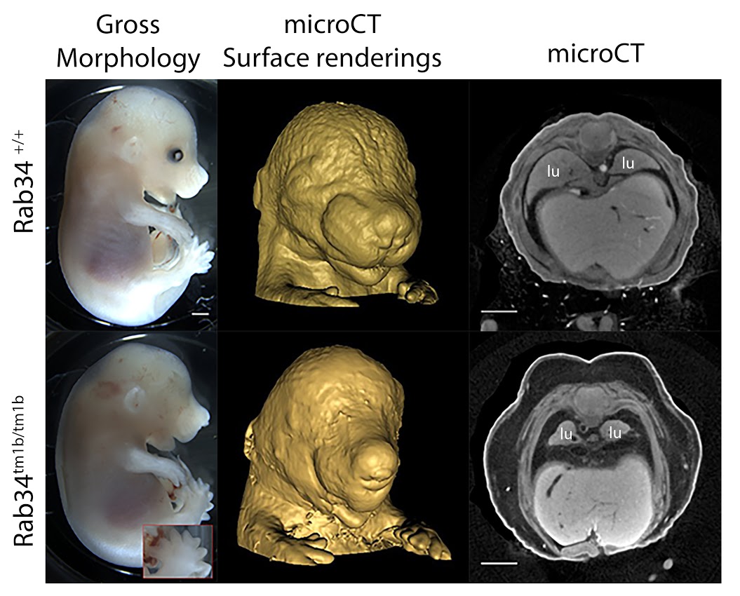 Cause of common form of vision loss discovered | IMPC | International ...